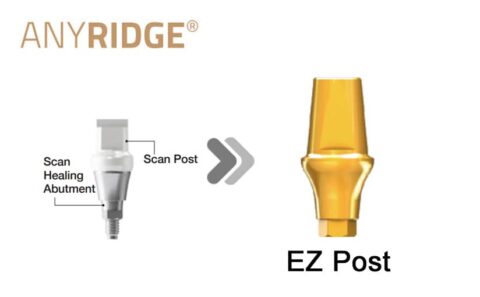 AnyRidge SHA EZ Post(Stock abutment) - MegaGen